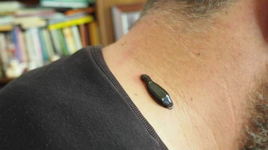Leech Stock Video Footage - 4K and HD Video Clips | Shutterstock