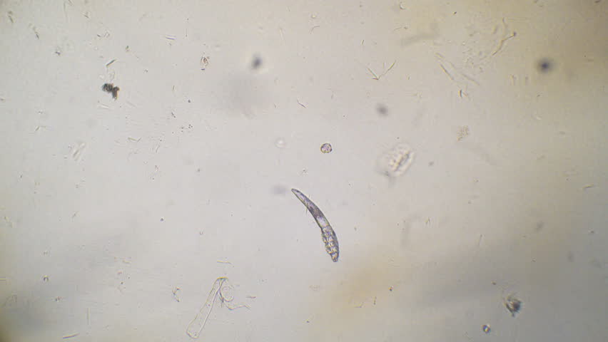 Demodectic Mange, Demodex (demodex Canis) Video de stock (totalmente ...