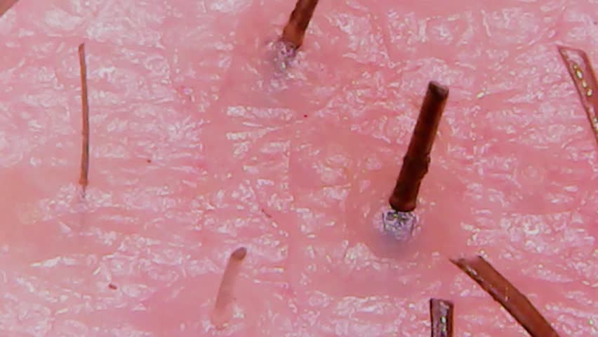 Nose Skin Under Microscope Full Stock Footage Video (100% Royalty-free ...