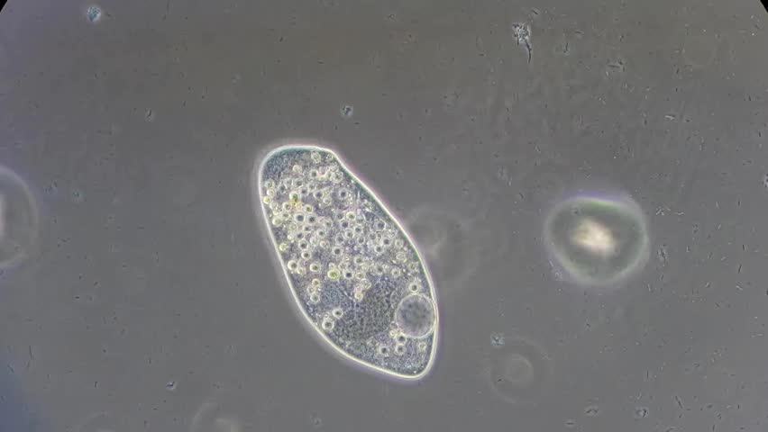 Full HD. Original Video Of Infusoria Under Microscope (phase-contrast ...