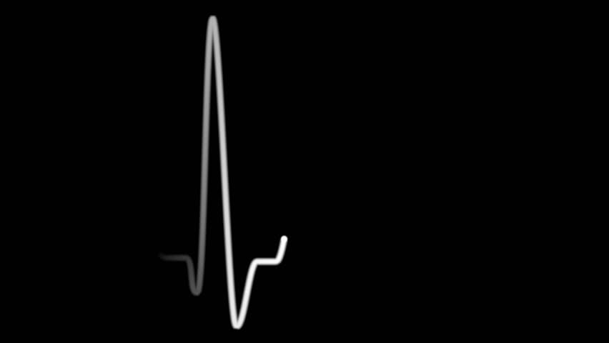 Stock video of green heart pulse line. animation of | 8345491 ...